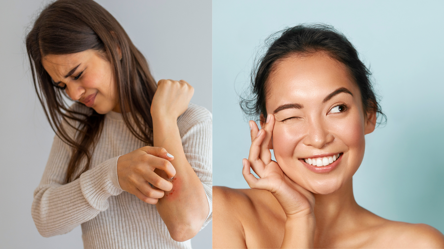 Soothing Relief: How the SHIFT Shower Filter Can Help with Eczema and ...